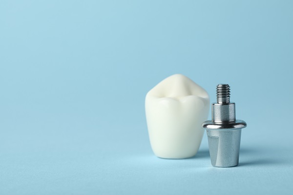 Periodontics Los Angeles Ca Allure Dentistry Periodontal Gum Disease